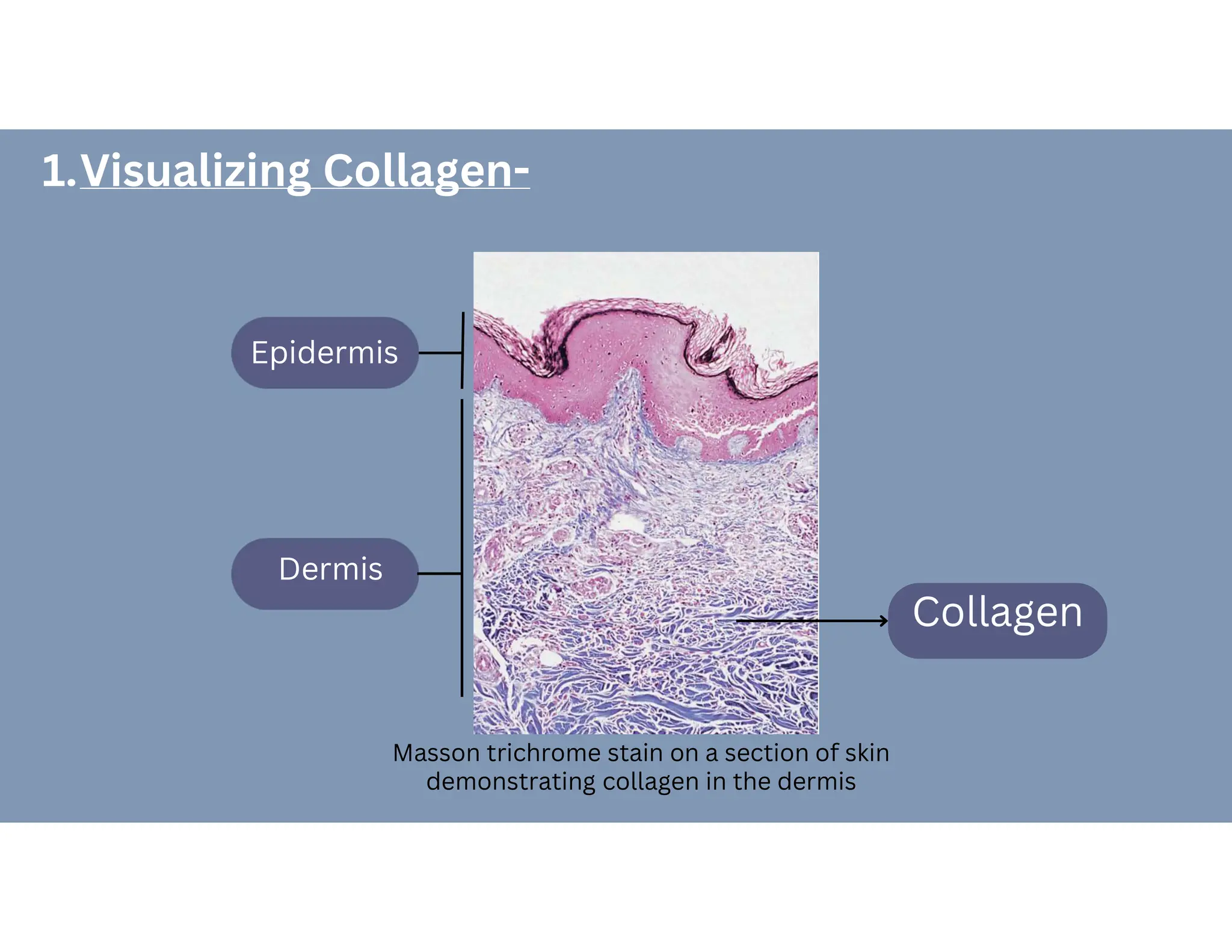 MASSON TRICHROME STAINS AND THEIR INTERPRETITIONS | PDF