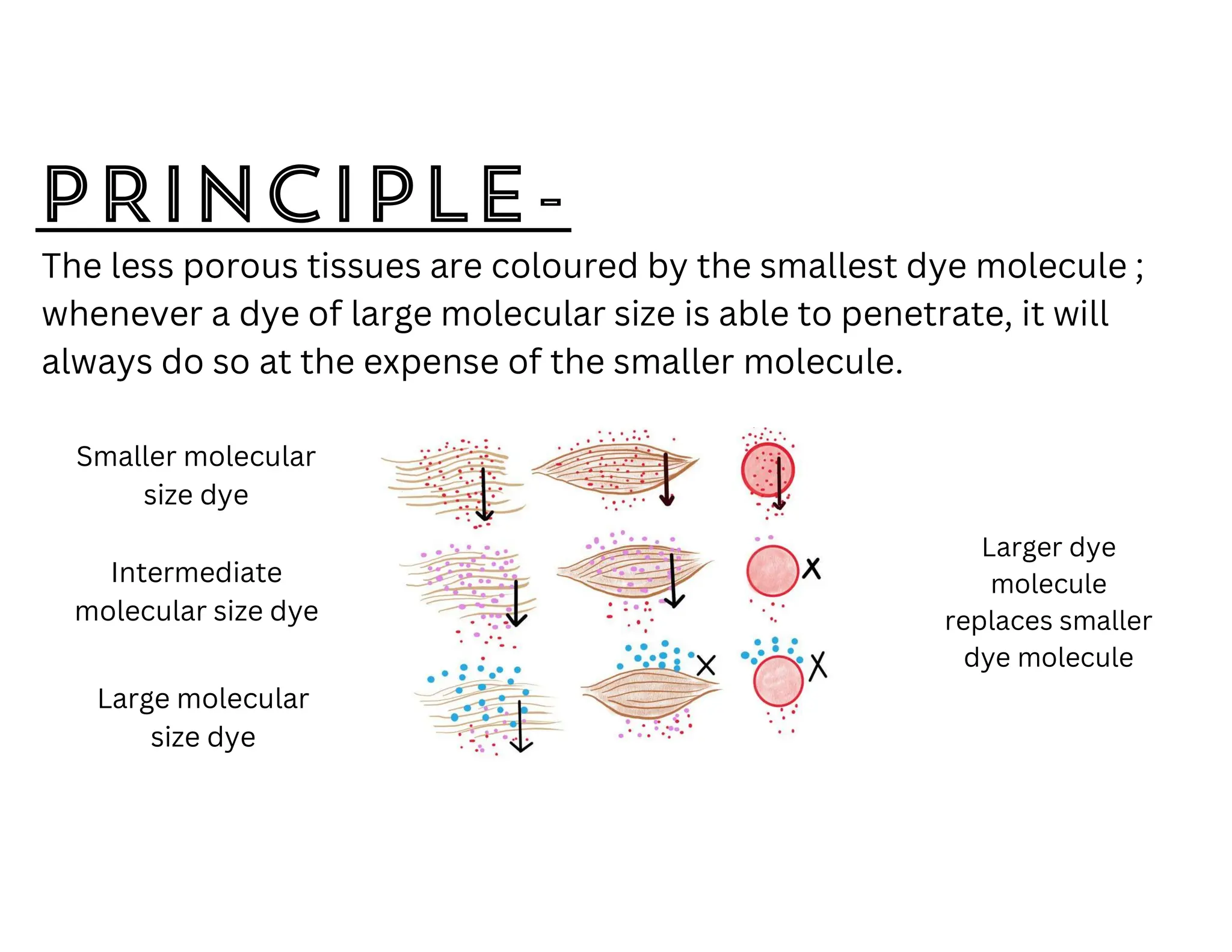 MASSON TRICHROME STAINS AND THEIR INTERPRETITIONS | PDF