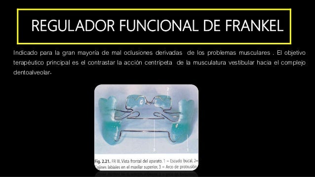 ORTOPEDIA FUNCIONAL DE LOS MAXILARES