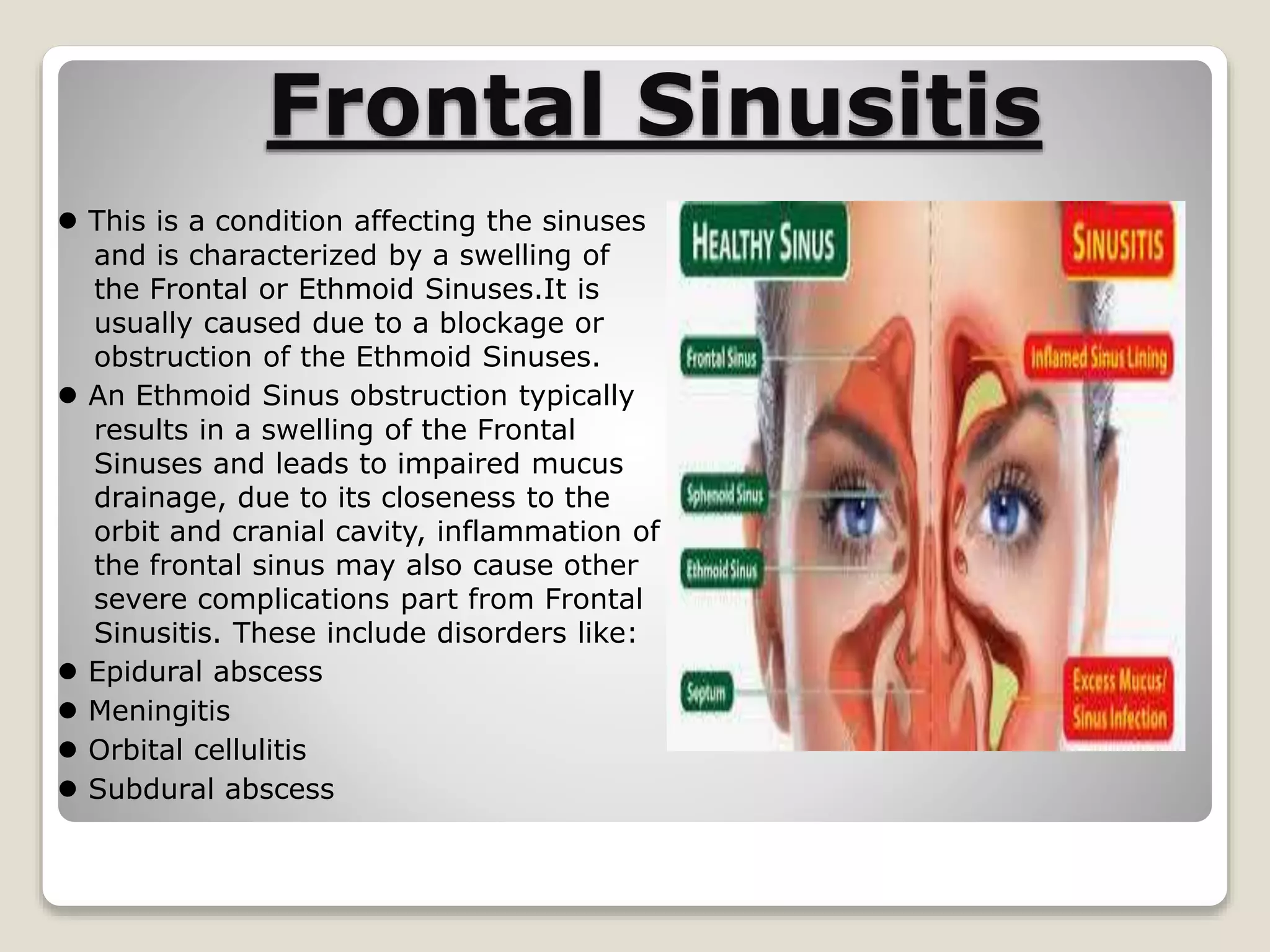 FRONTAL SINUS | PPTX