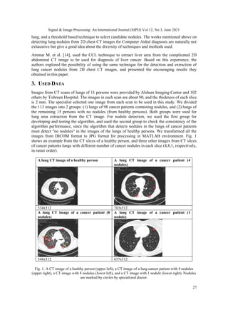 USING DISTANCE MEASURE BASED CLASSIFICATION IN AUTOMATIC EXTRACTION OF LUNGS CANCER NODULES FOR ...