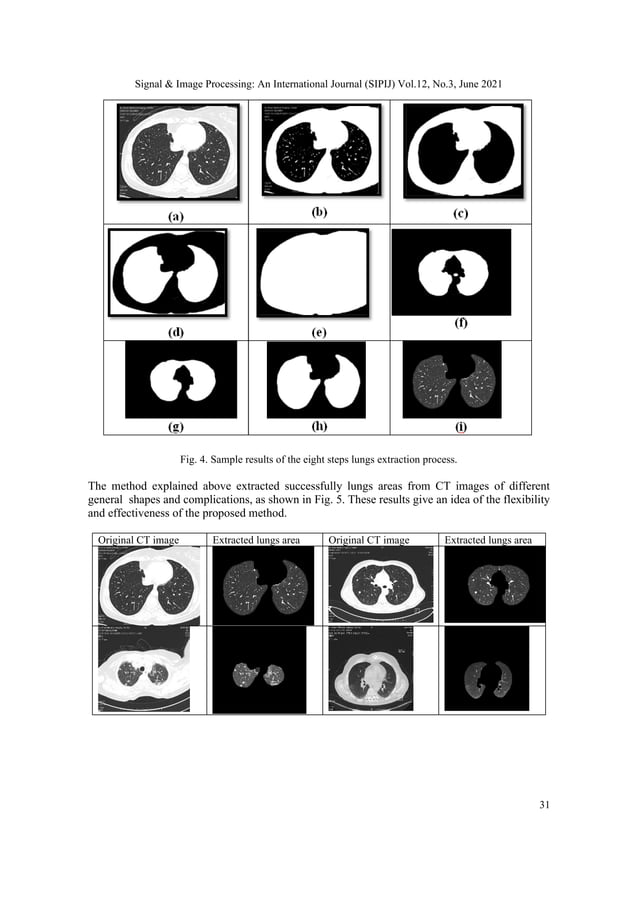 Using Distance Measure Based Classification In Automatic Extraction Of Lungs Cancer Nodules For