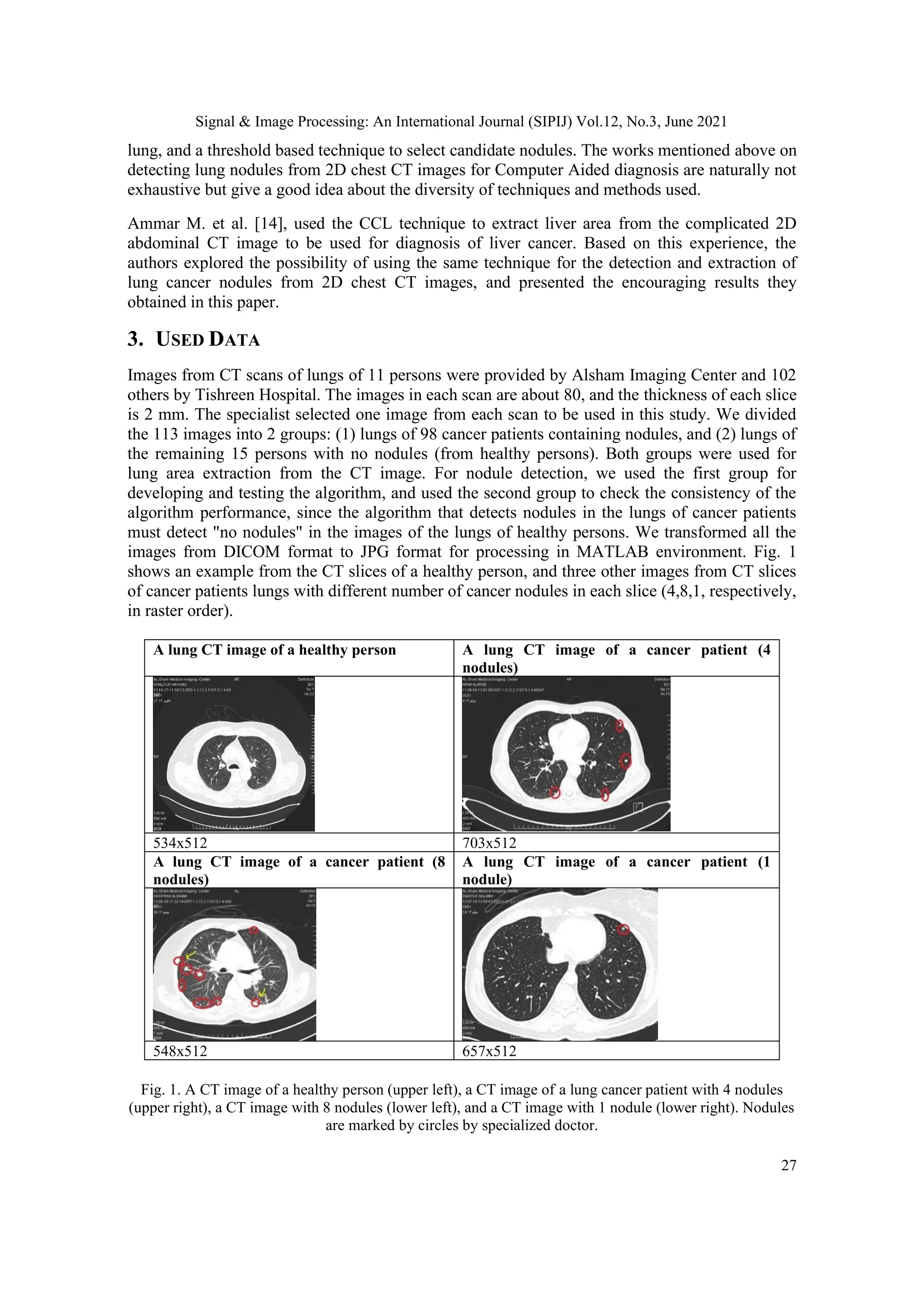 Using Distance Measure Based Classification In Automatic Extraction Of Lungs Cancer Nodules For