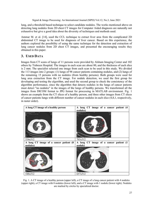Using Distance Measure based Classification in Automatic Extraction of Lungs Cancer Nodules for ...