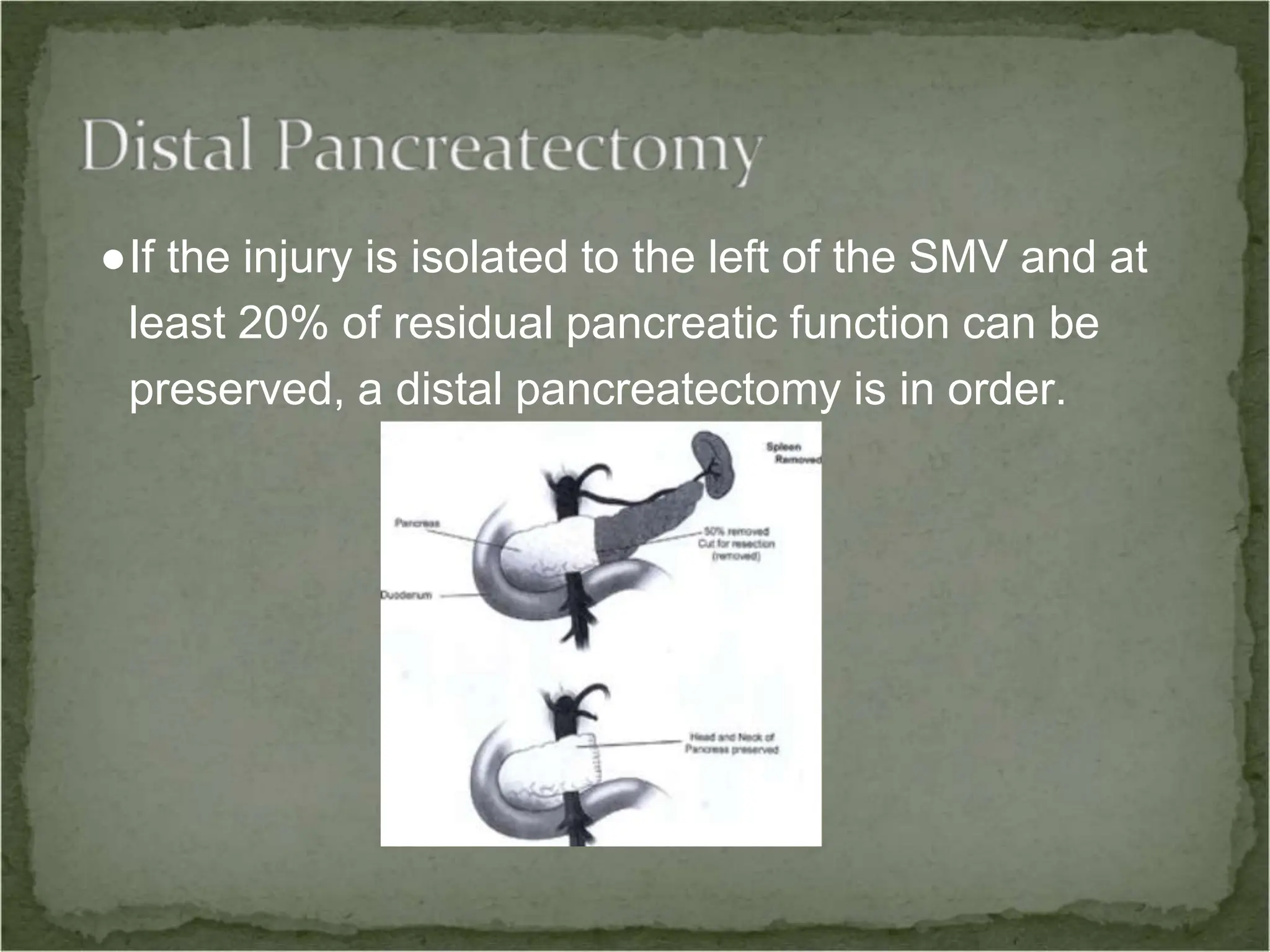 Pancreatic trauma , causes and treatment | PDF