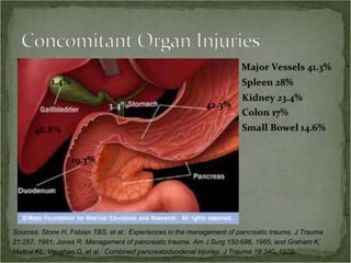 Pancreatic trauma , causes and treatment | PDF