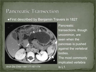 Pancreatic trauma , causes and treatment | PDF