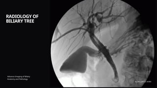 BILIARY TREE RADIOLOGY ADVANCE IMAGING (USG, CT SCAN, MRI AND ERCP) OF ...