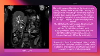 BILIARY TREE RADIOLOGY ADVANCE IMAGING (USG, CT SCAN, MRI AND ERCP) OF ...