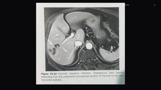 BILIARY TREE RADIOLOGY ADVANCE IMAGING (USG, CT SCAN, MRI AND ERCP) OF ...