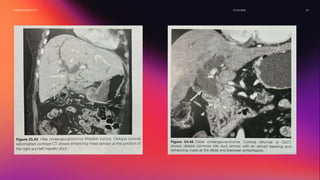 BILIARY TREE RADIOLOGY ADVANCE IMAGING (USG, CT SCAN, MRI AND ERCP) OF ...