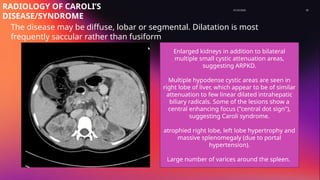 BILIARY TREE RADIOLOGY ADVANCE IMAGING (USG, CT SCAN, MRI AND ERCP) OF ...