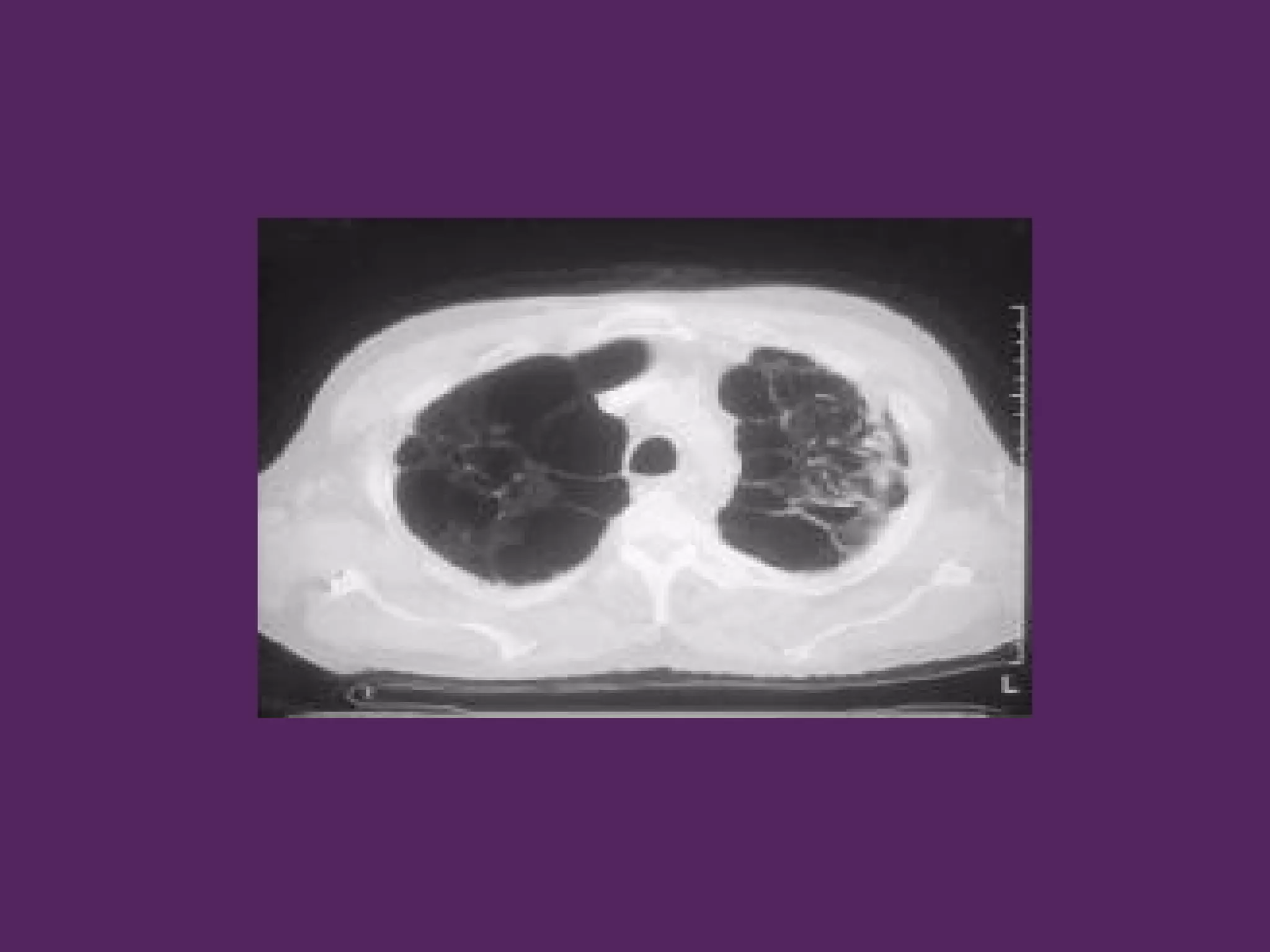 [123doc] - benh-hoc-copd-dieu-tri-copd-ths-bs-vo-pham-minh-thu.pdf