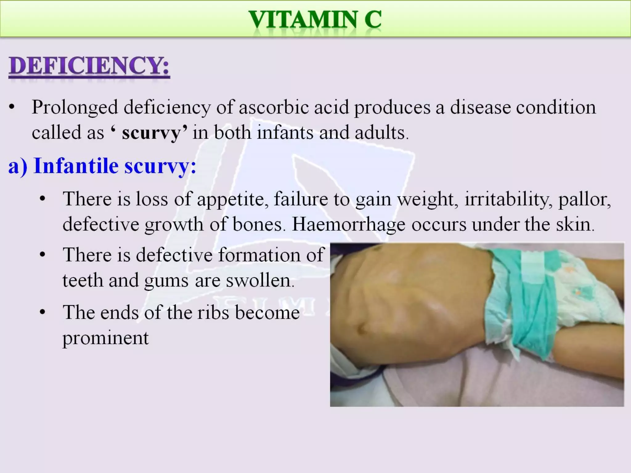 VITAMINS (Classification, sources, Functions, Requirement and Deficiency conditions) | PDF