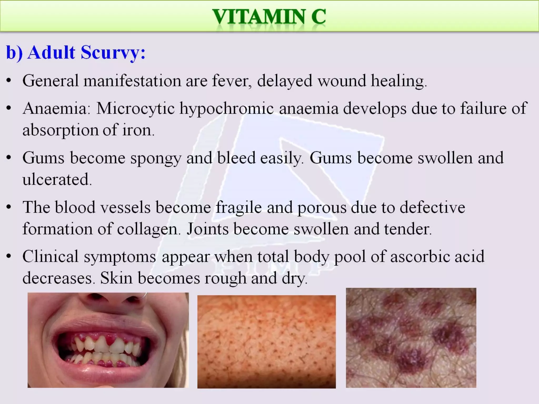 VITAMINS (Classification, sources, Functions, Requirement and ...