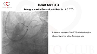 Felix Woitek: Best CTO Case of the Month | PPT