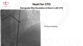 Felix Woitek: Best CTO Case of the Month | PPTX