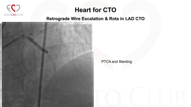 Felix Woitek: Best CTO Case of the Month | PPT