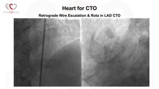 Felix Woitek: Best CTO Case of the Month | PPTX