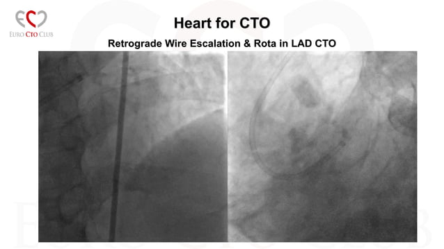 Felix Woitek: Best CTO Case of the Month | PPT