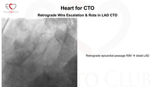 Felix Woitek: Best CTO Case of the Month | PPTX