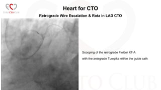 Felix Woitek: Best CTO Case of the Month | PPTX