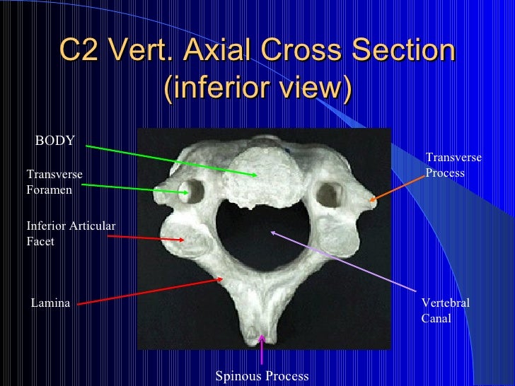 125 Week 11 Cervical Spine