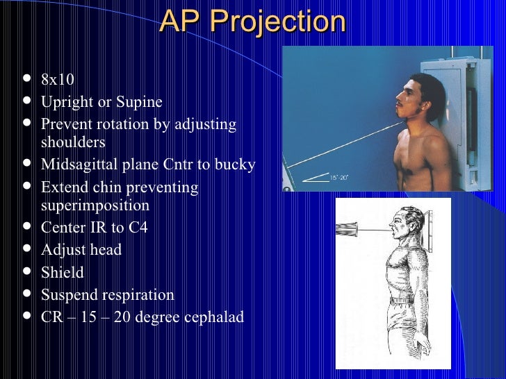 125 Week 11 Cervical Spine