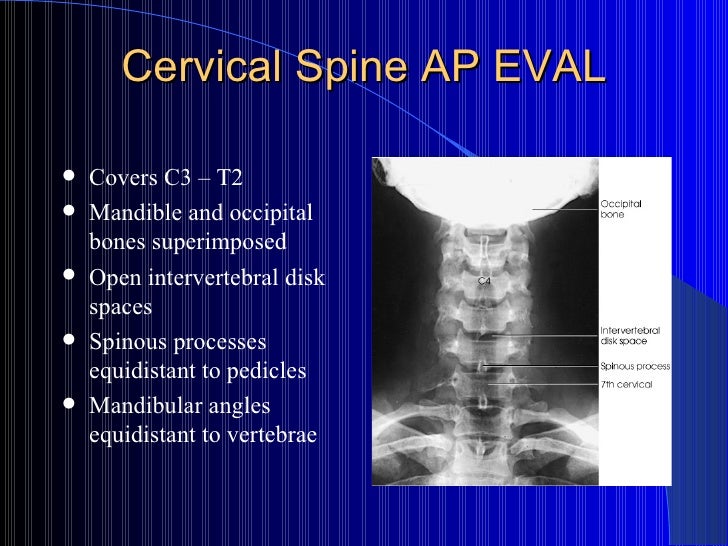 125 Week 11 Cervical Spine