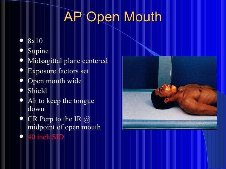 125 Week 11 Cervical Spine