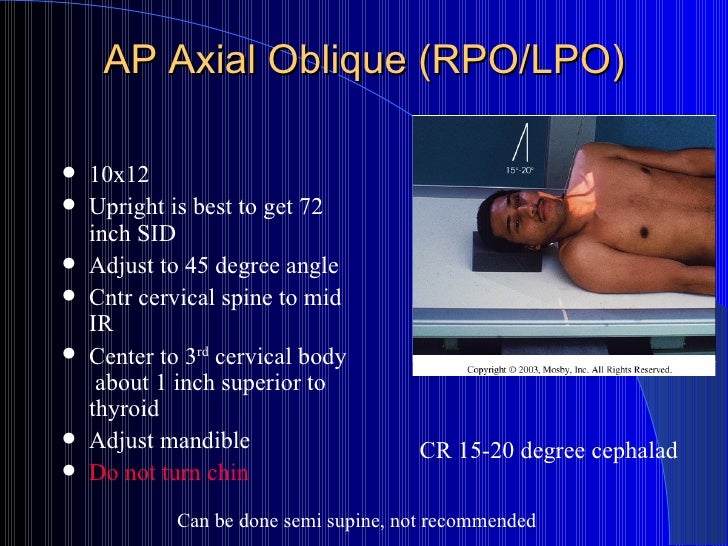 125 Week 11 Cervical Spine
