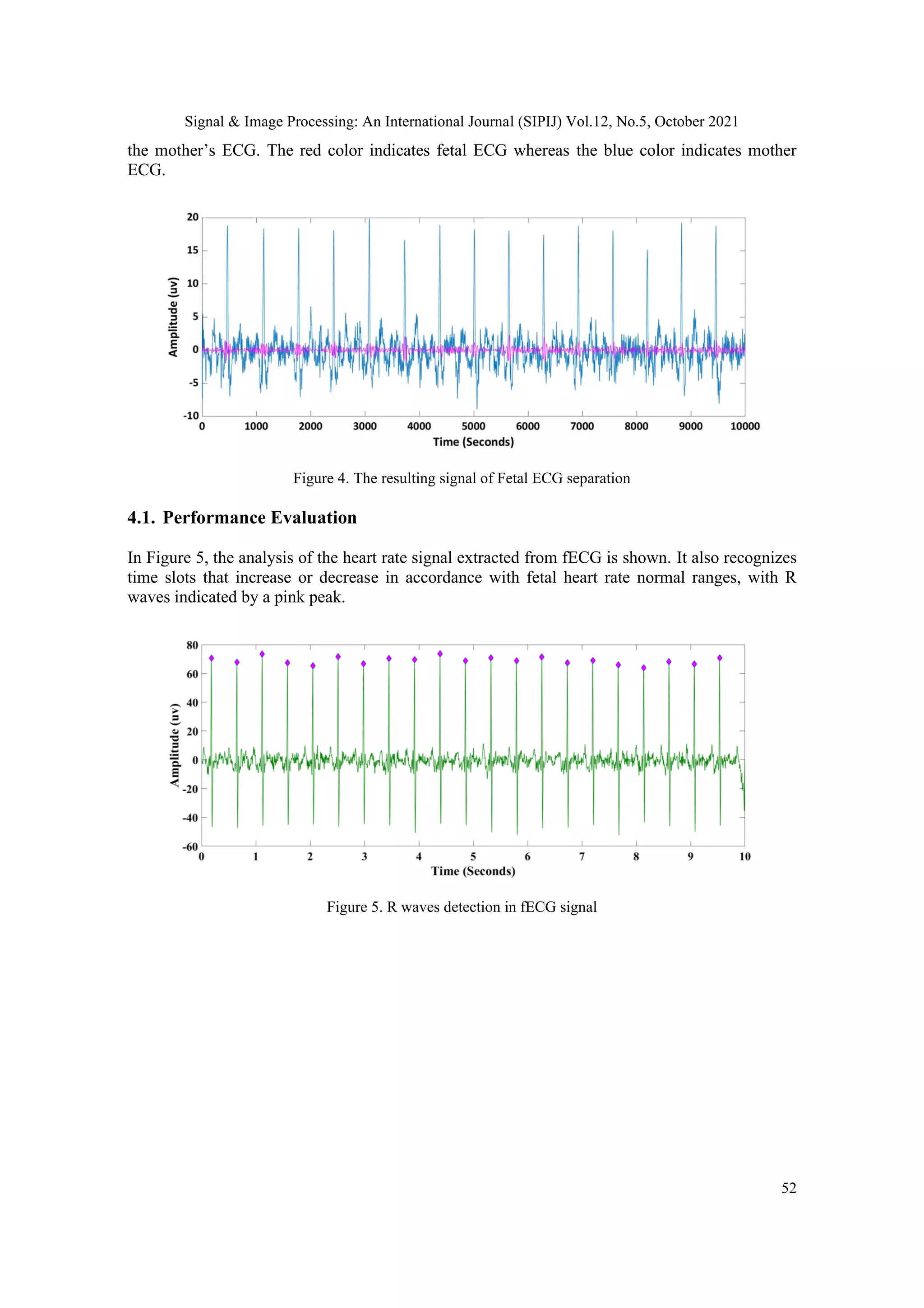 FRACTIONAL ORDER BUTTERWORTH FILTER FOR FETAL ELECTROCARDIOGRAPHIC SIGNAL FEATURE EXTRACTION | PDF