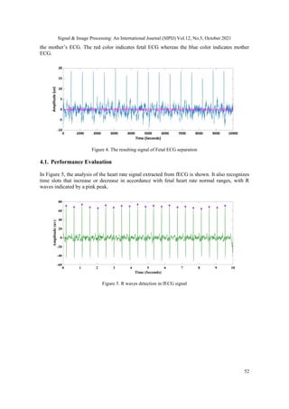 Fractional Order Butterworth Filter for Fetal Electrocardiographic ...