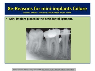 126 failure mini-implant-miniscrews in orthodontics-case report-oussama ...