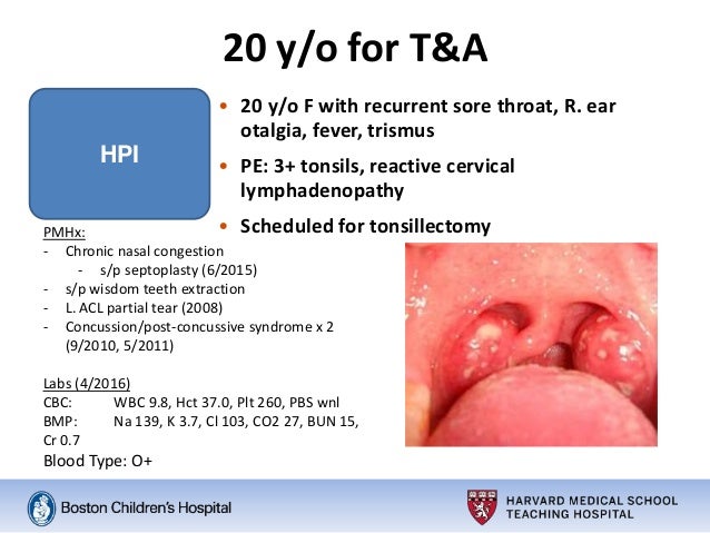 Post-Tonsillectomy Bleed and One-Lung Ventilation - Anesthetic Manage…