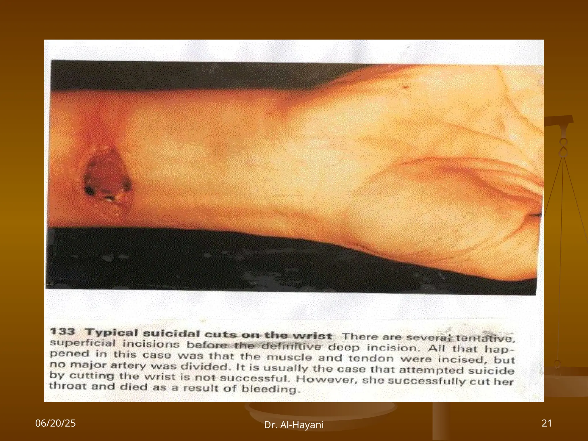 Wounds and Injuries Study Wounds and Injuries | PPT