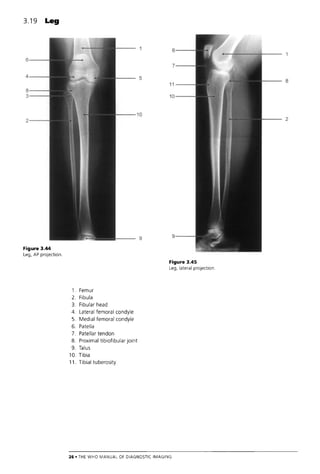 The Who Manual Of Diagnostic Imaging Radiographic Anatomy And ...