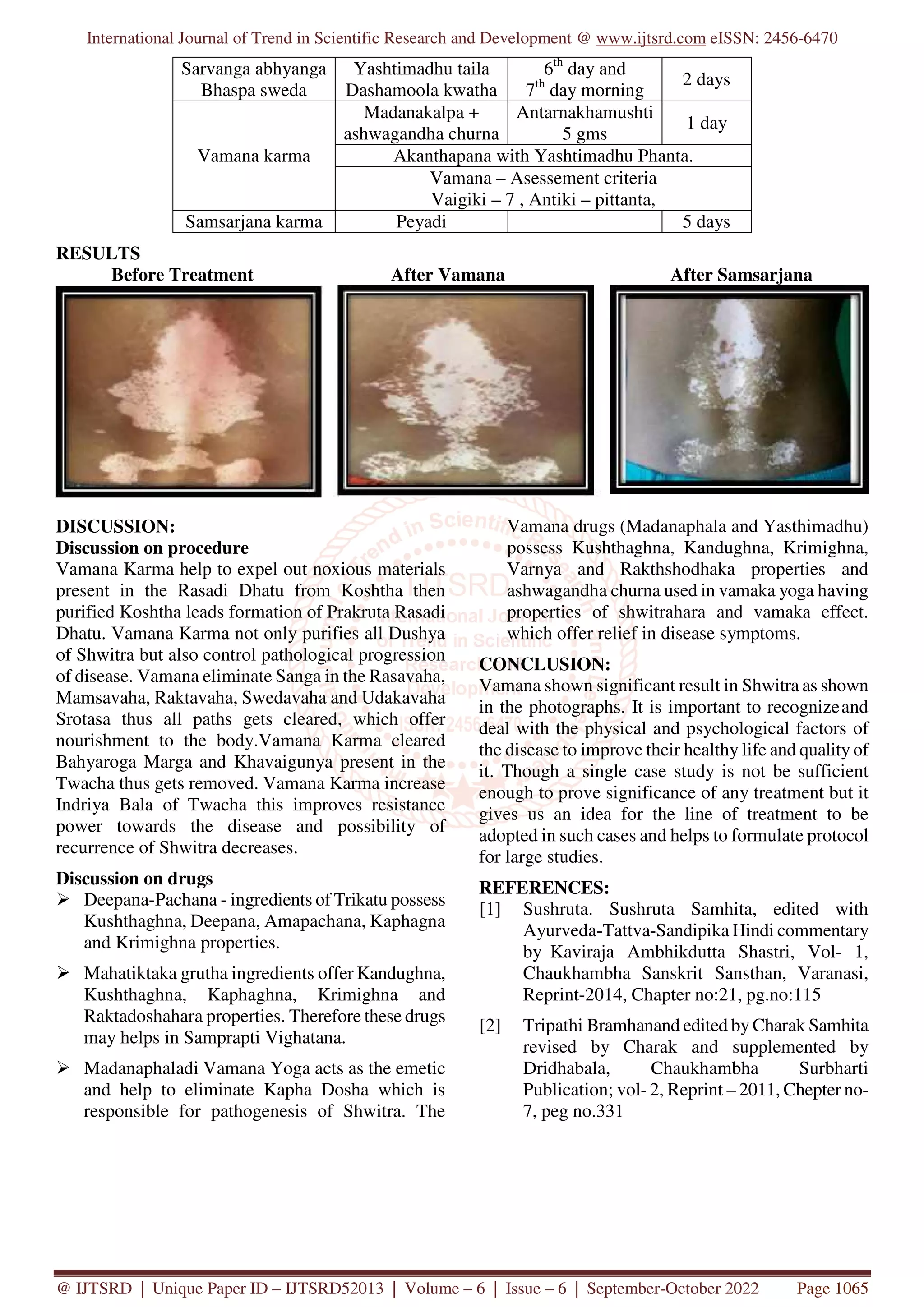 Role of Vamana in the Management of Switra with Special Reference to ...