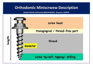 129 temporary anchorage devices in orthodontics-miniscrews-mini ...