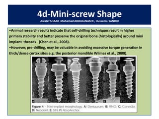 129 temporary anchorage devices in orthodontics-miniscrews-mini ...