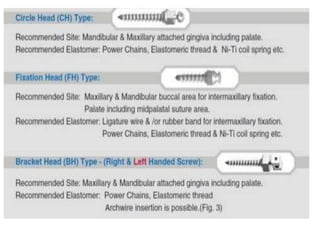 129 temporary anchorage devices in orthodontics-miniscrews-mini ...