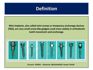 129 temporary anchorage devices in orthodontics-miniscrews-mini ...