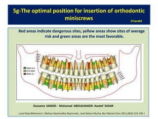 129 temporary anchorage devices in orthodontics-miniscrews-mini ...