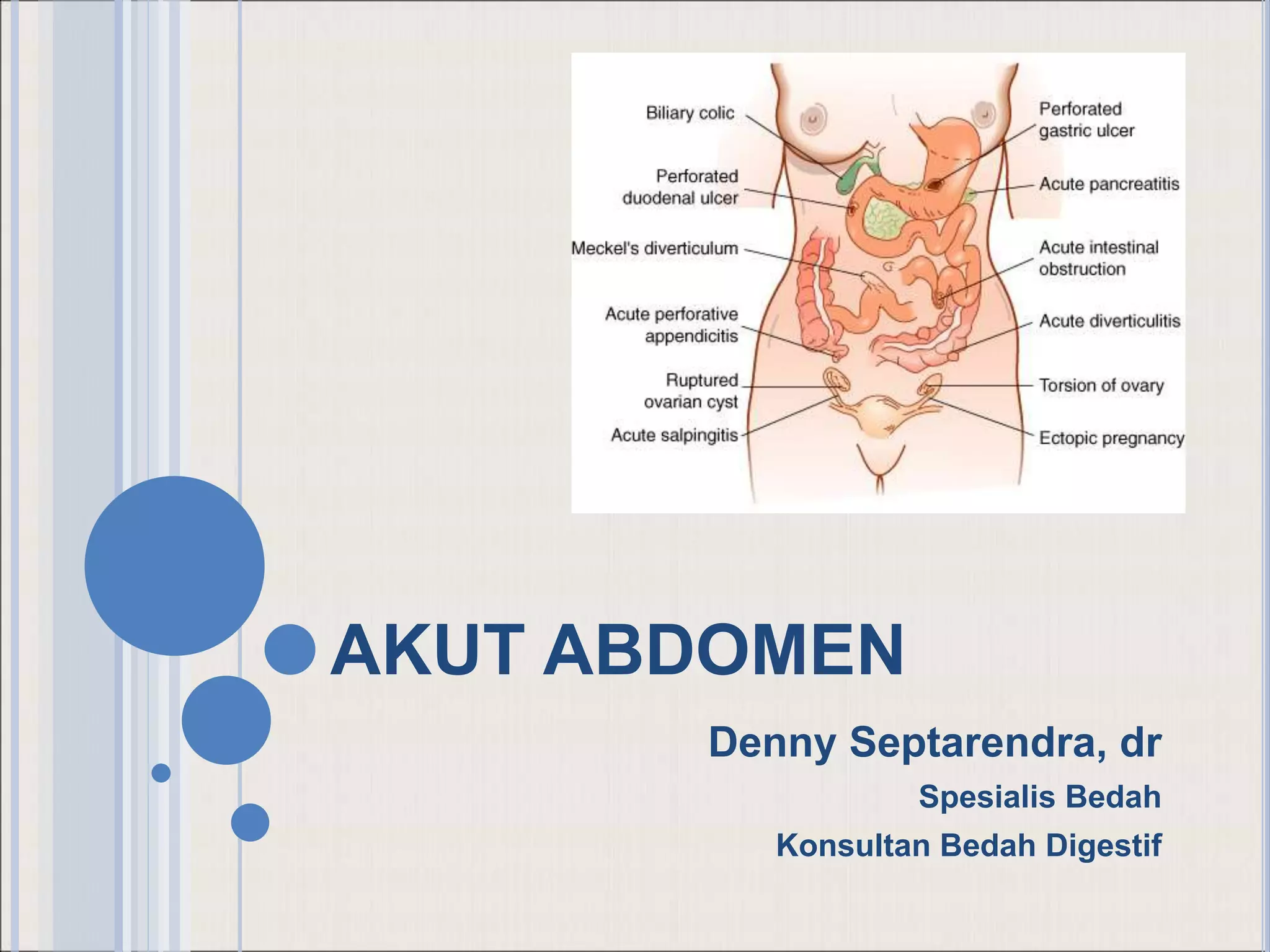 12a. Akut Abdomen.ppt