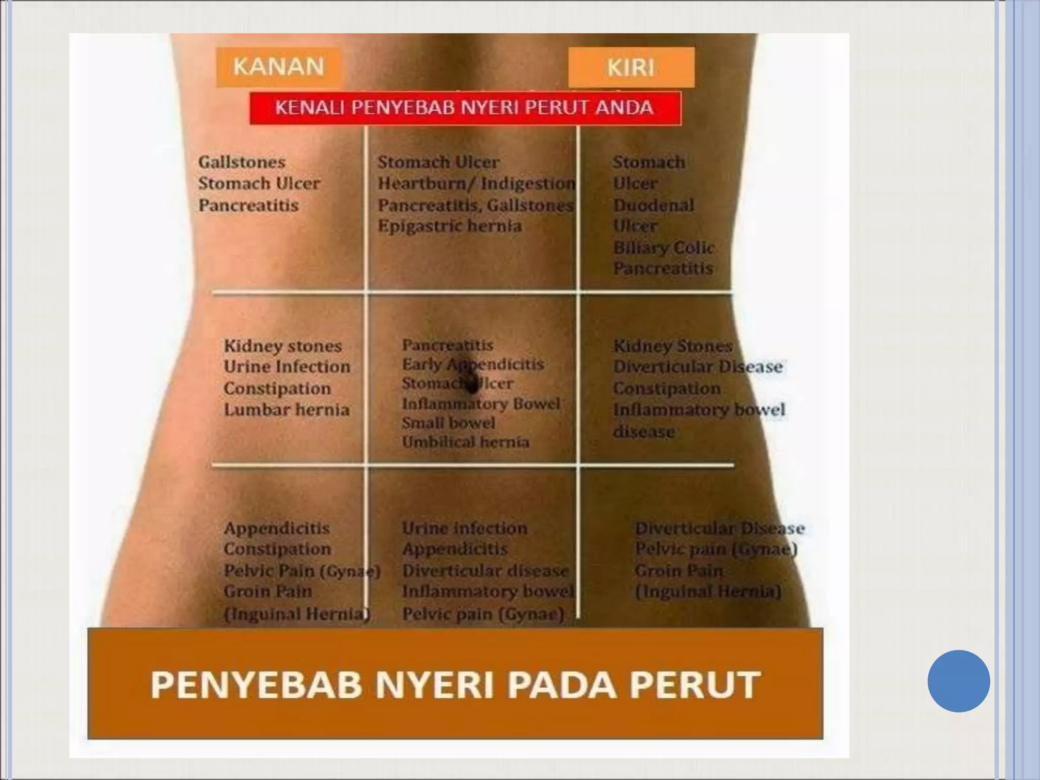 12a. Akut Abdomen.ppt