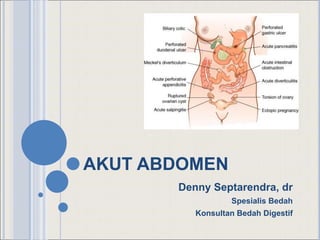 12a. Akut Abdomen.ppt