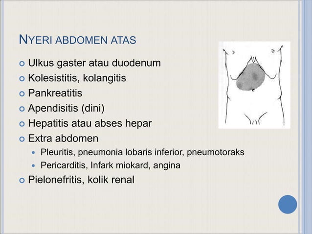 12a. Akut Abdomen.ppt