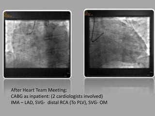 Severe Left Main Coronary Artery Disease with Early Graft Failure ...