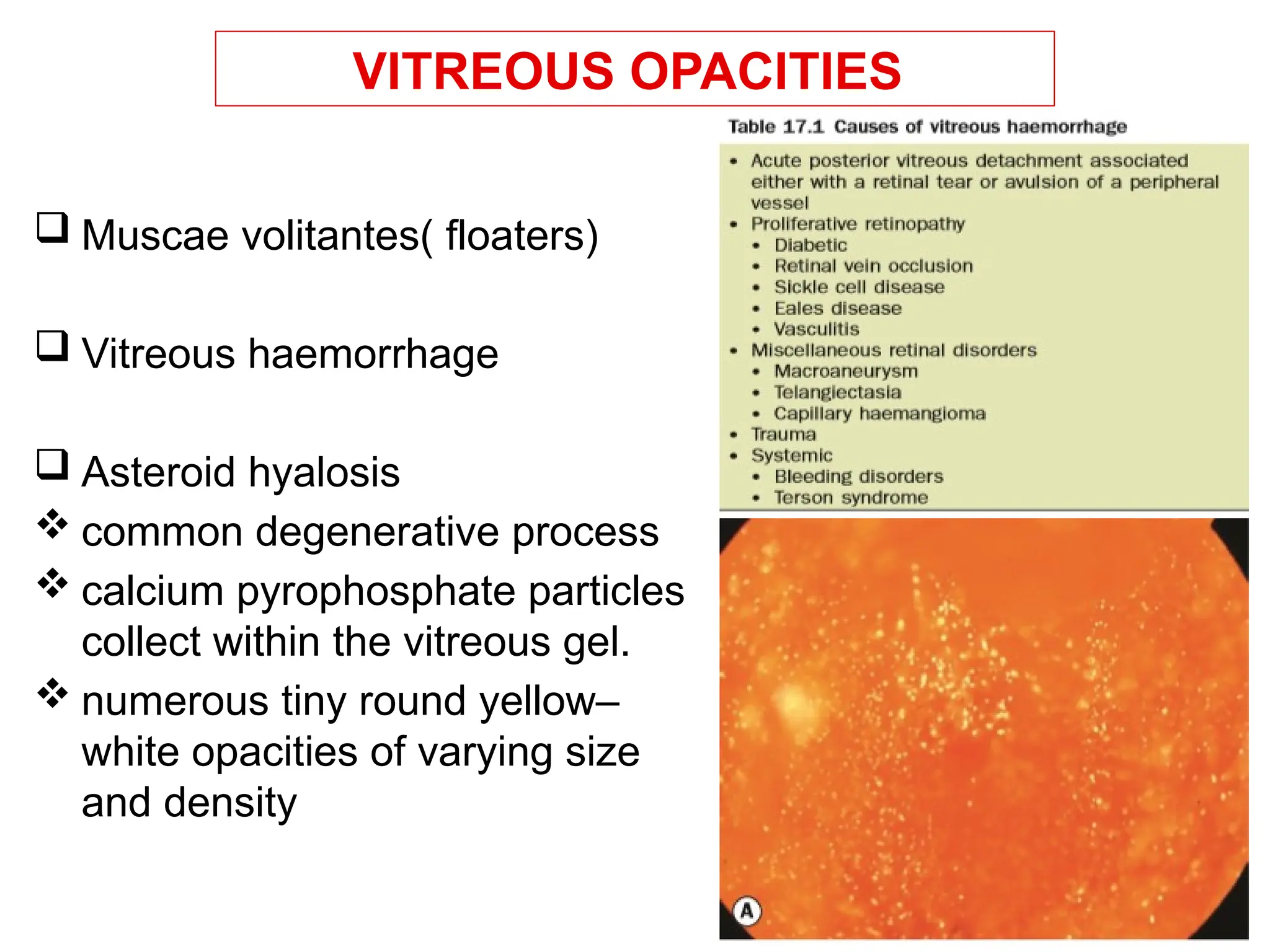 Anatomy and physiology Vitreous ppt final.pptx