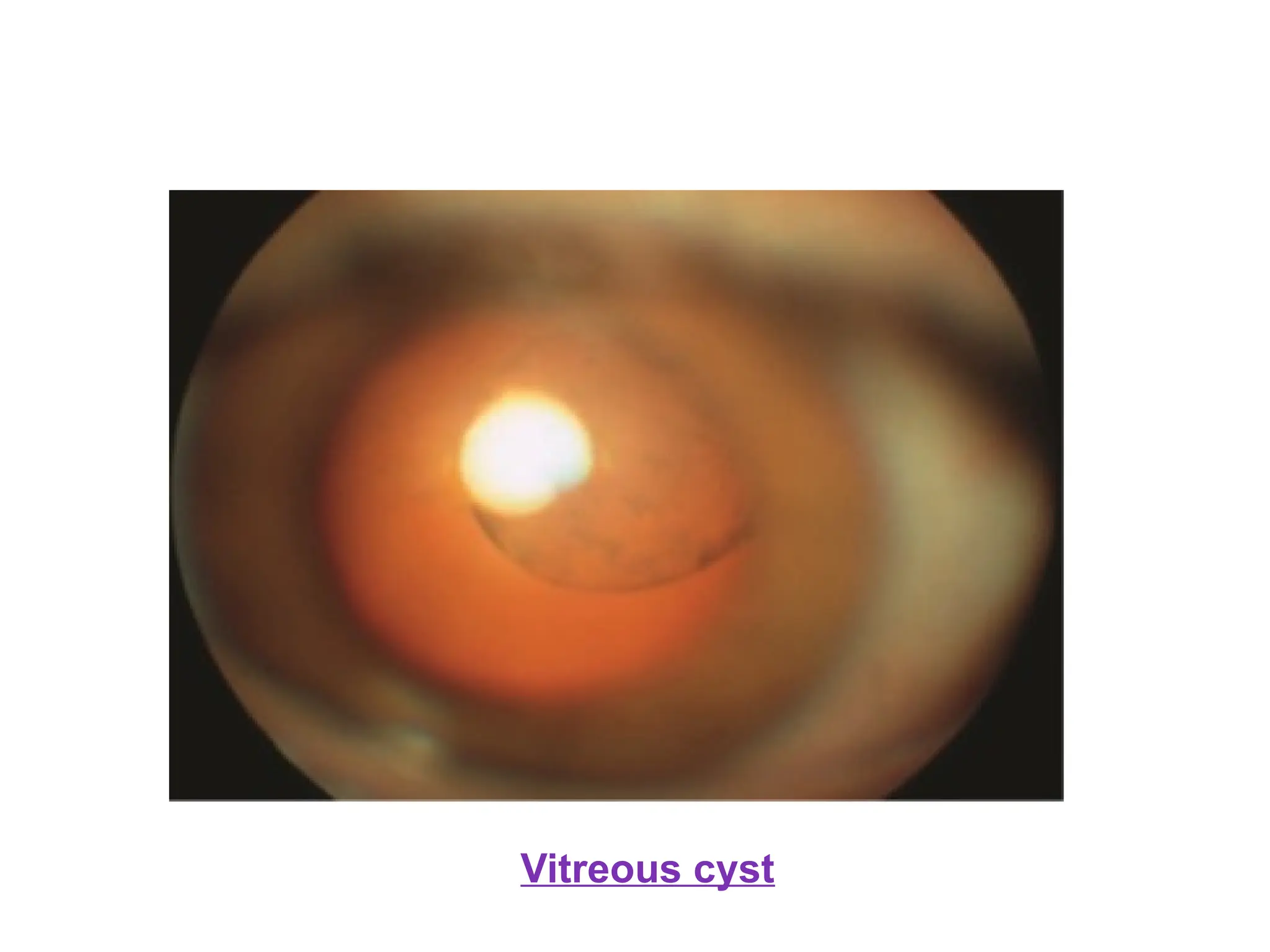 Anatomy and physiology Vitreous ppt final.pptx